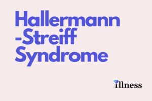Hallermann-Streiff Syndrome : Overview, Causes, Symptoms, Treatment ...