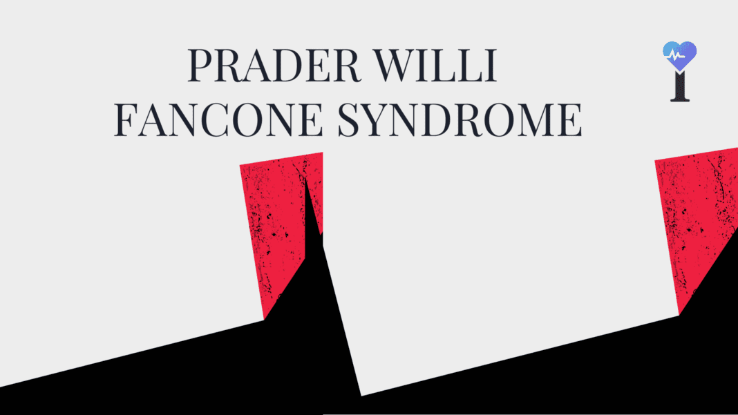 Prader Willi Syndrome : Overview, Causes, Symptoms, Treatment - illness.com