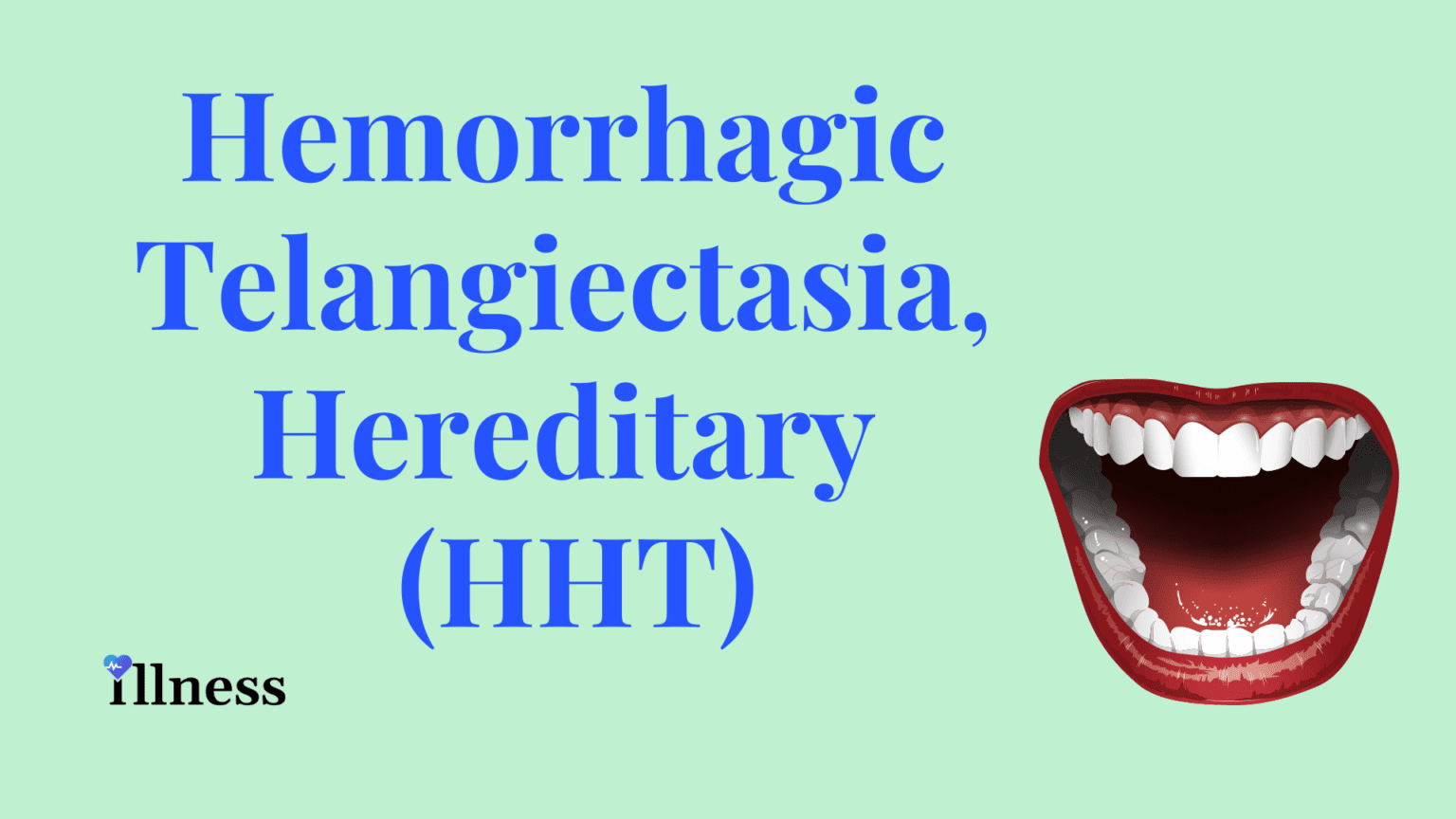 Hereditary Hemorrhagic Telangiectasia (HHT) : Overview, Causes ...