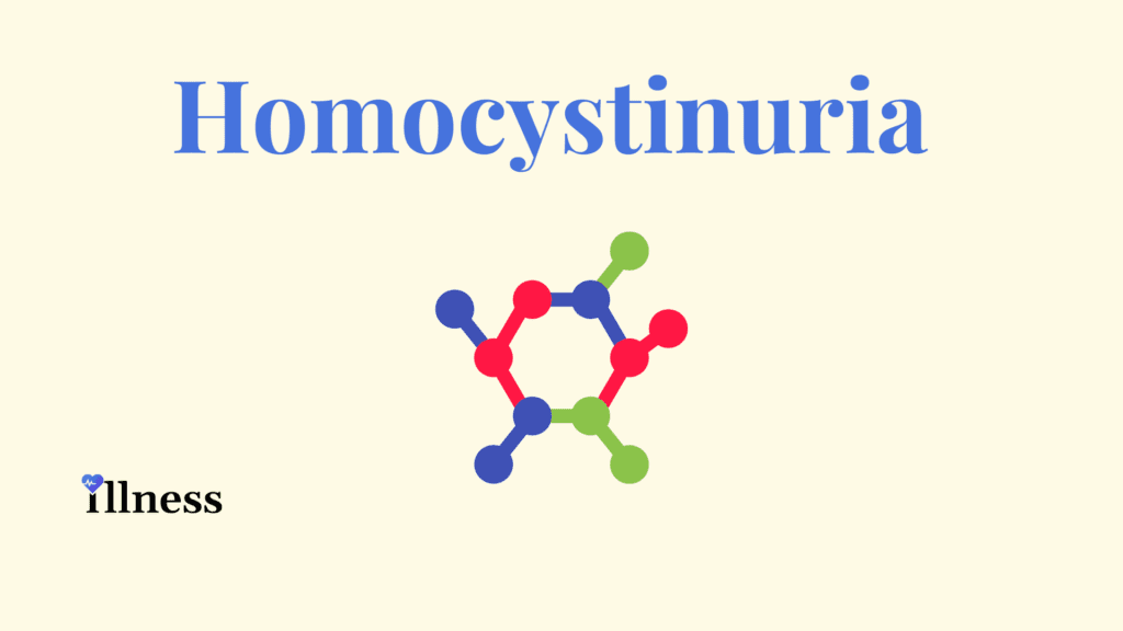 Homocystinuria : Overview- illness.com