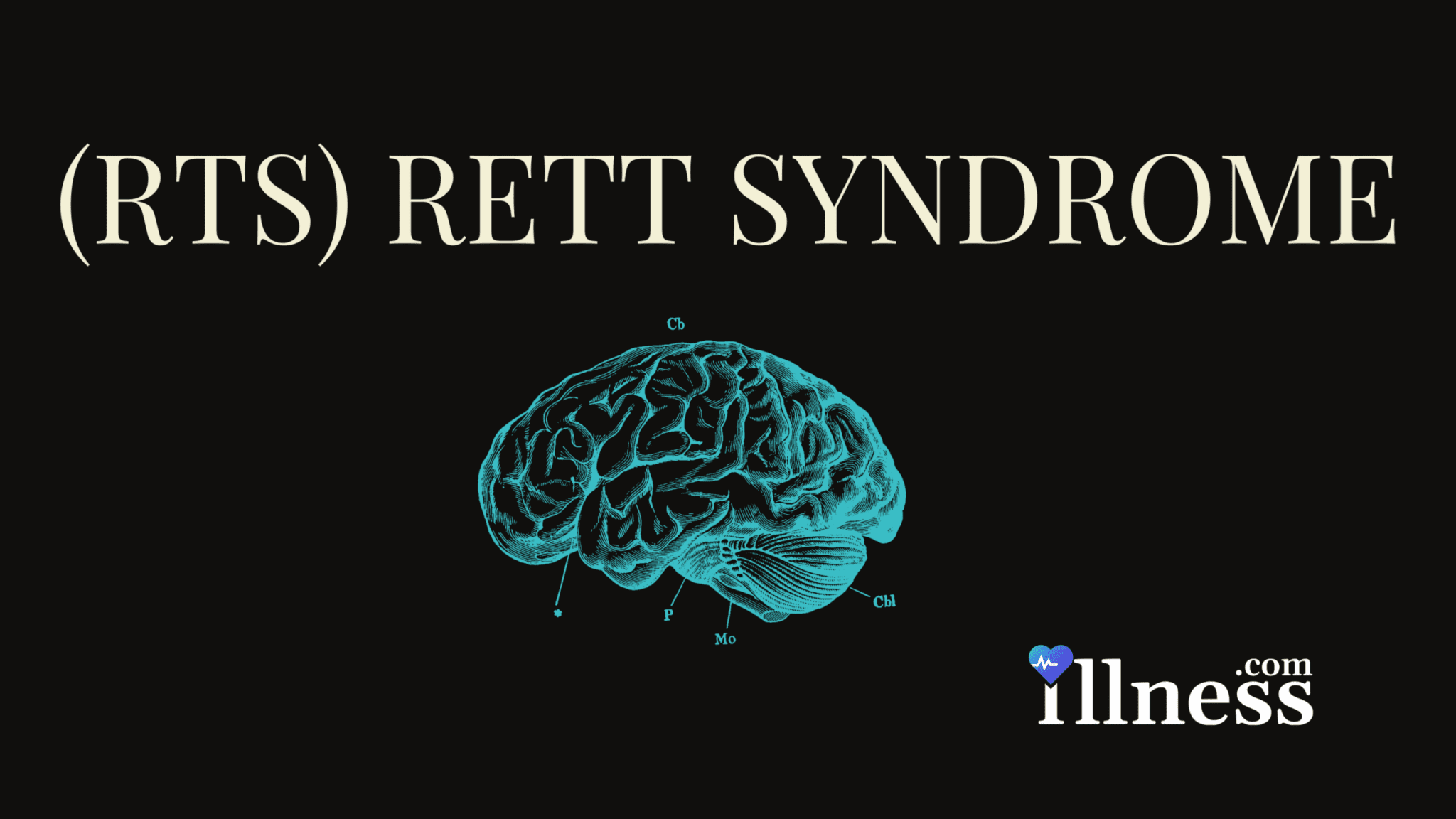 Rett Syndrome : Overview, Causes, Symptoms, Treatment - illness.com