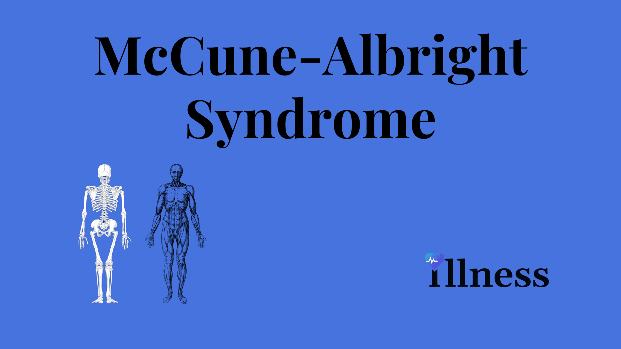 McCune-Albright Syndrome : Overview, Causes, Symptoms, Treatment ...