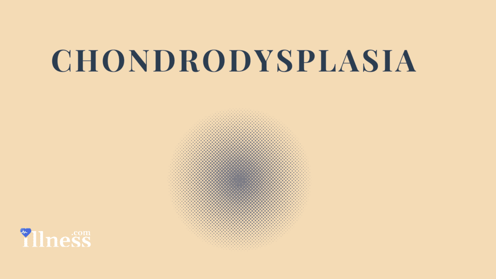Rhizomelic Chondrodysplasia Punctata : Overview, Causes, Symptoms ...