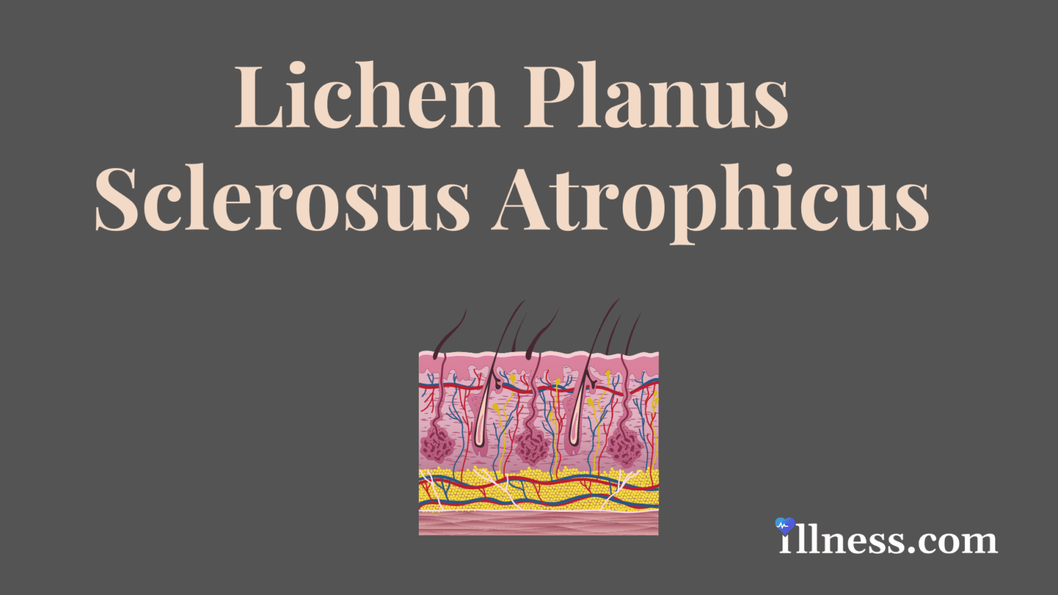 Lichen Planus Sclerosus Atrophicus : Overview, Causes, Symptoms ...