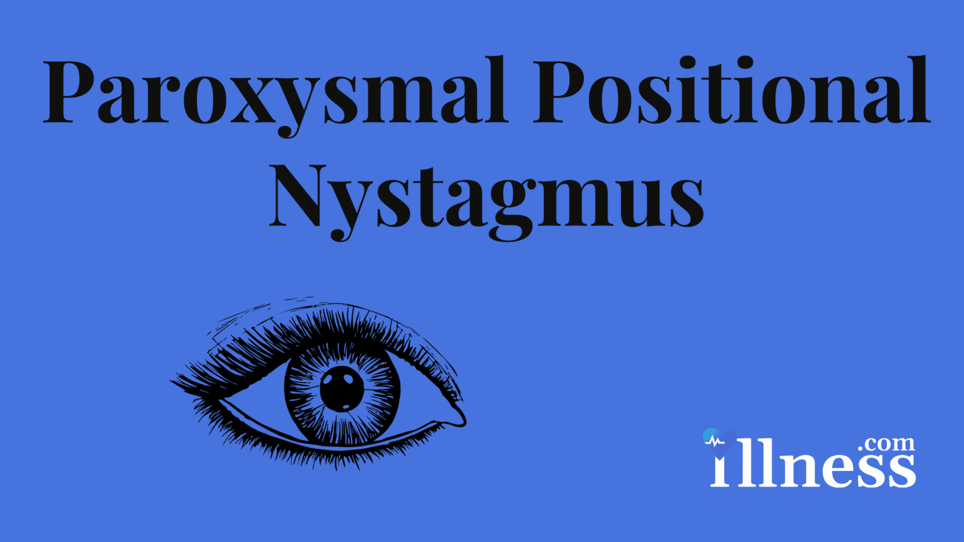 Benign Paroxysmal Positional Vertigo : Overview, Causes, Symptoms ...