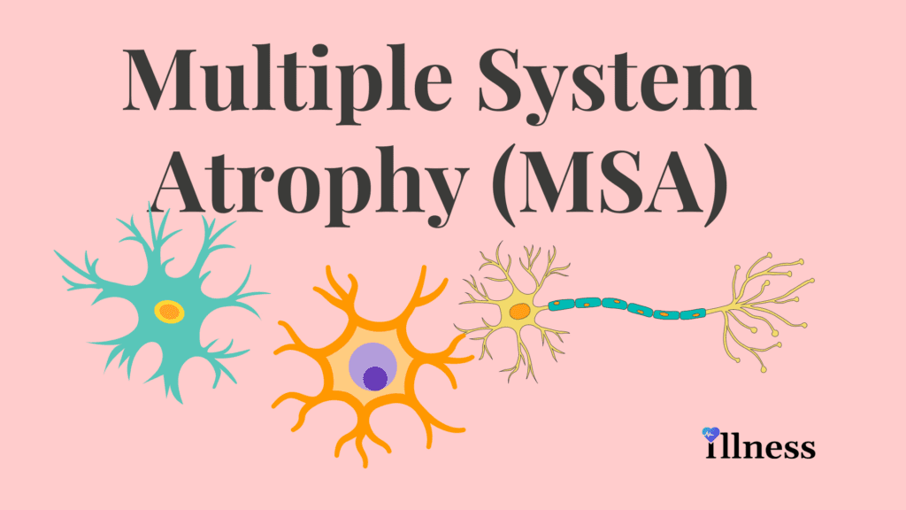 Multiple System Atrophy : Overview, Causes, Symptoms, Treatment ...