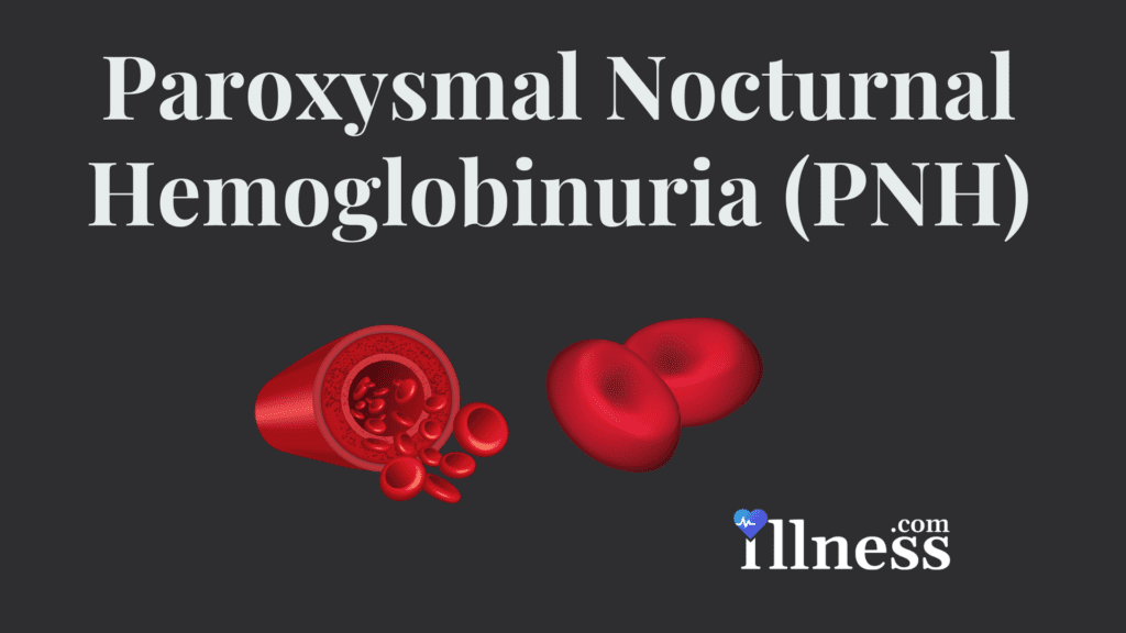 Paroxysmal Nocturnal Hemoglobinuria (PNH) : Overview - illness.com